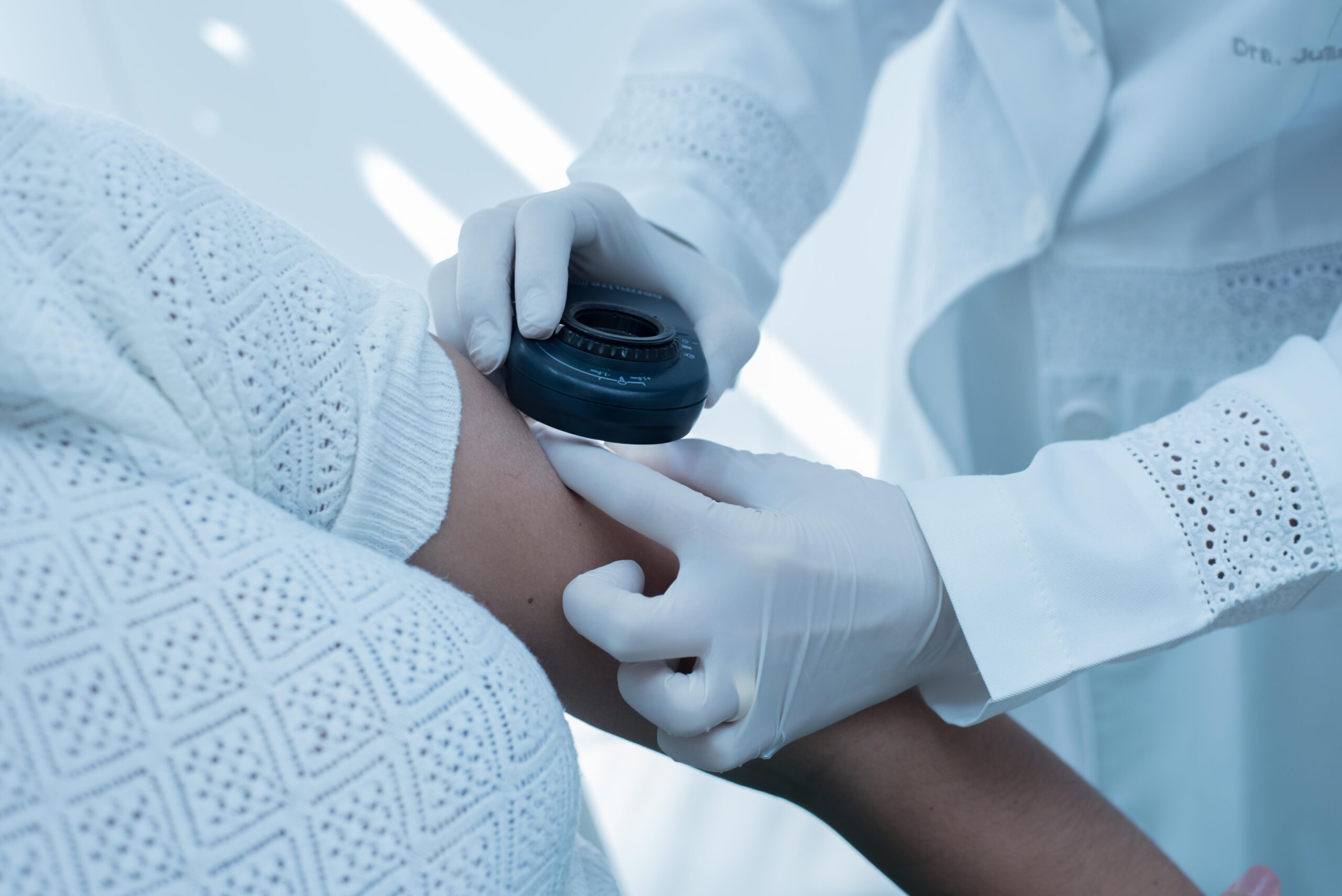 Dermatoscopia - Clínica Juliana Hypolito