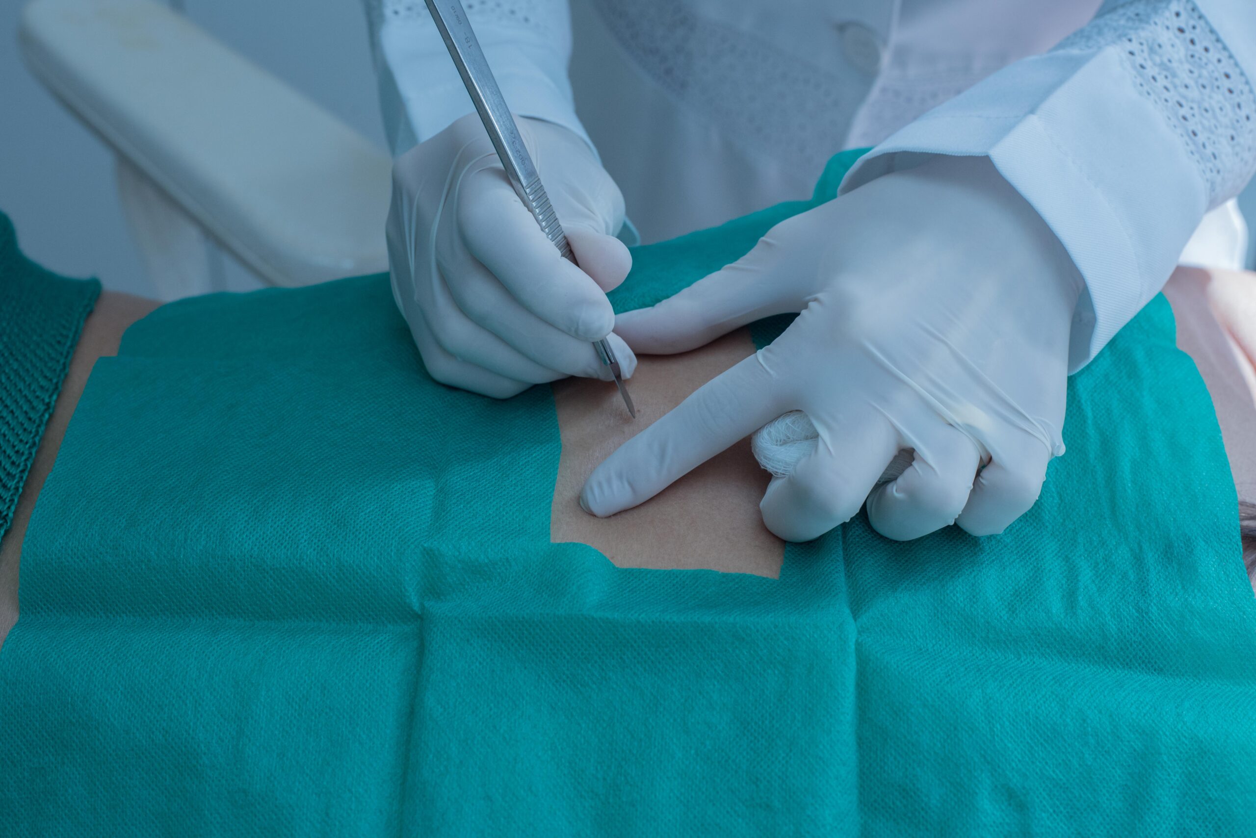 Exérese - Clínica Juliana Hypolito