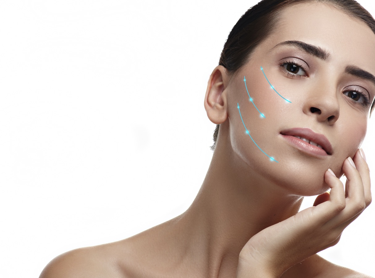 Fios de pdo - Clínica Juliana Hypolito